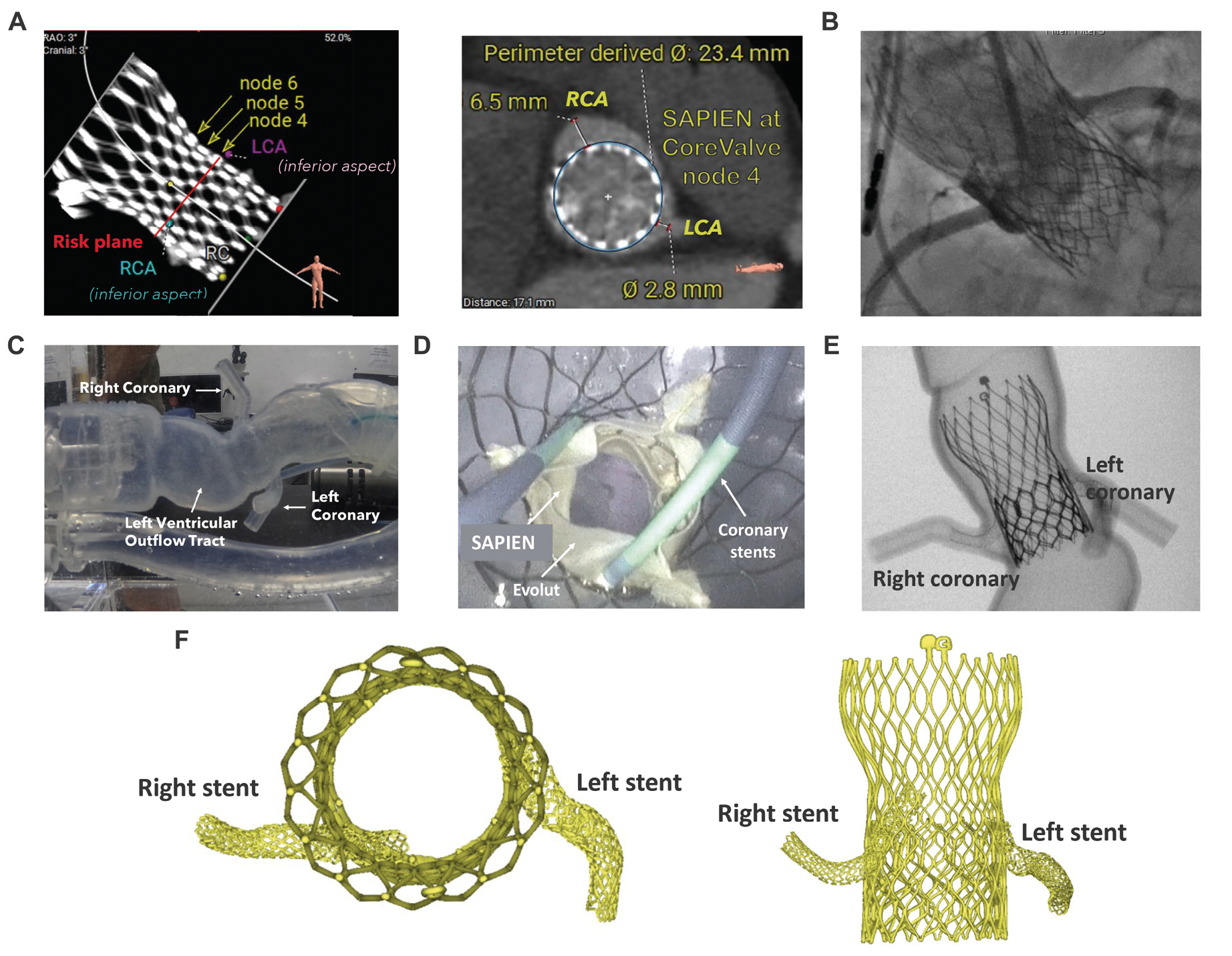 EuroIntervention | The Official Journal of EuroPCR and the European ...
